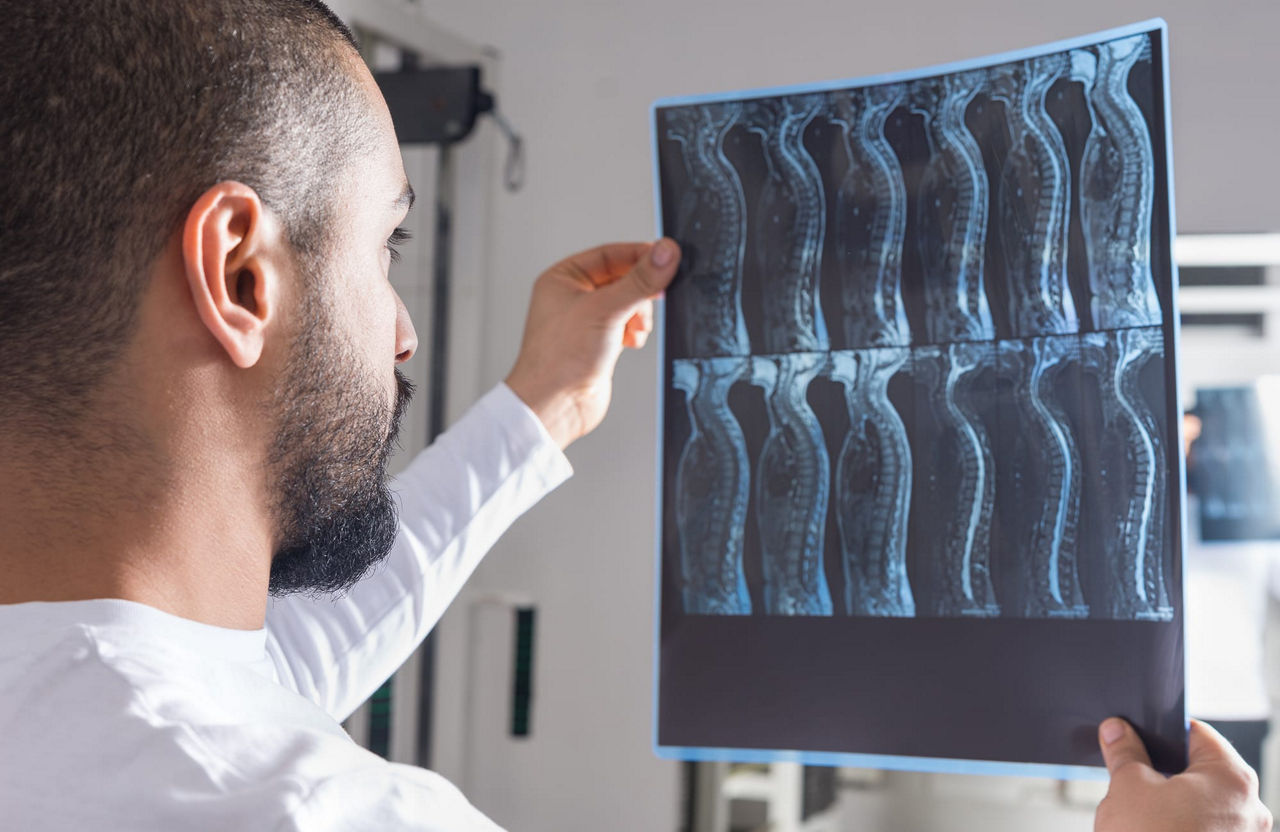 Smart Spinal Cord Simulator for Pain Management | Virtusa